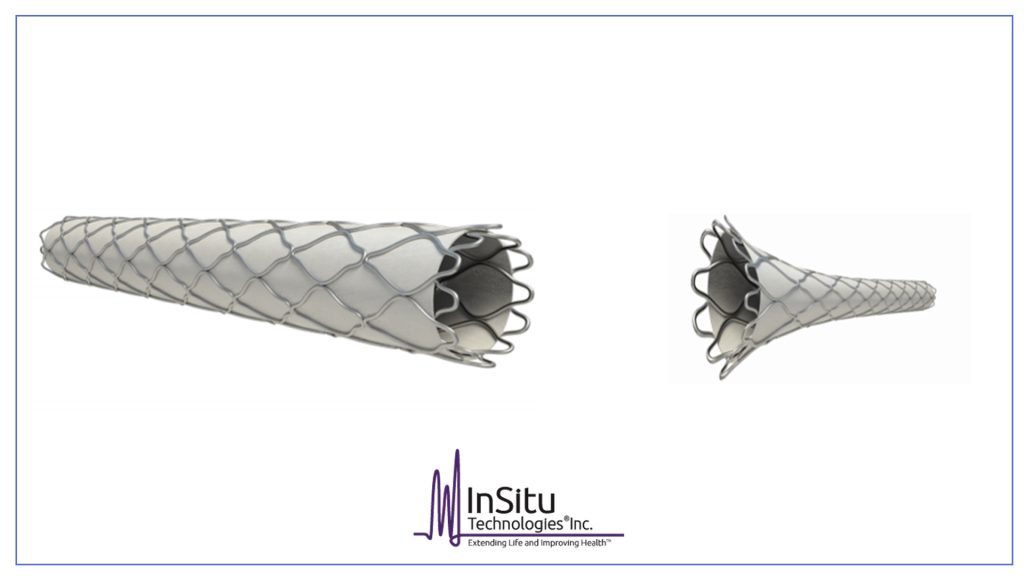 Coronary Stent Graft